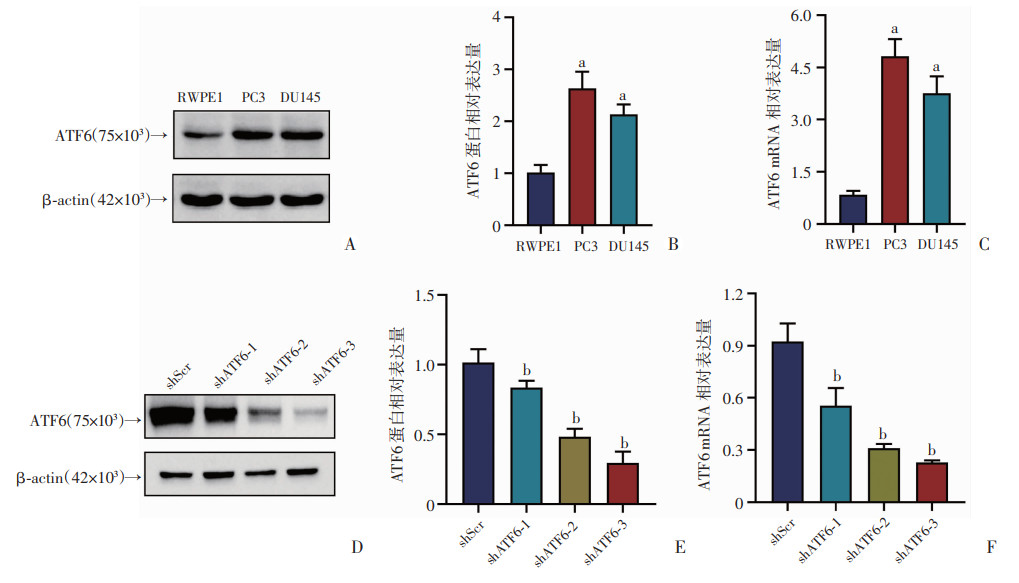 ATF6通过Hippo-YAP信号通路促进前列腺癌PC3细胞的增殖、迁移和侵袭