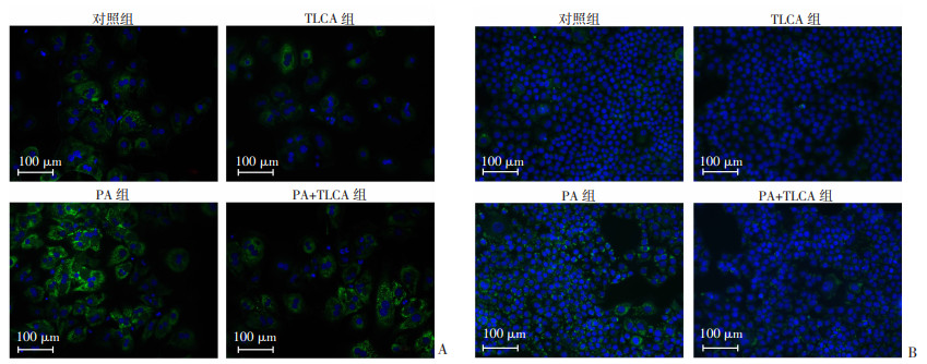 牛磺石胆酸通过TGR5调节巨噬细胞极化改善肝细胞脂质沉积